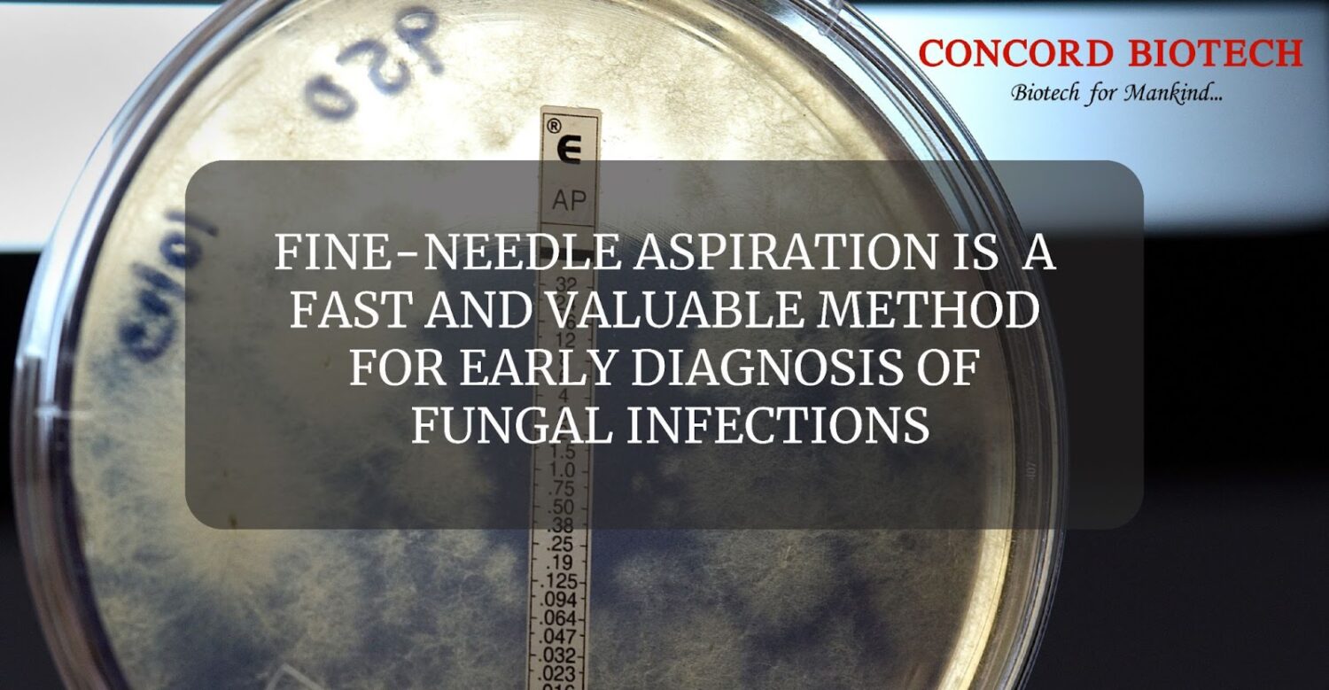 Fine-Needle Aspiration is a Fast and Valuable Method for Early ...